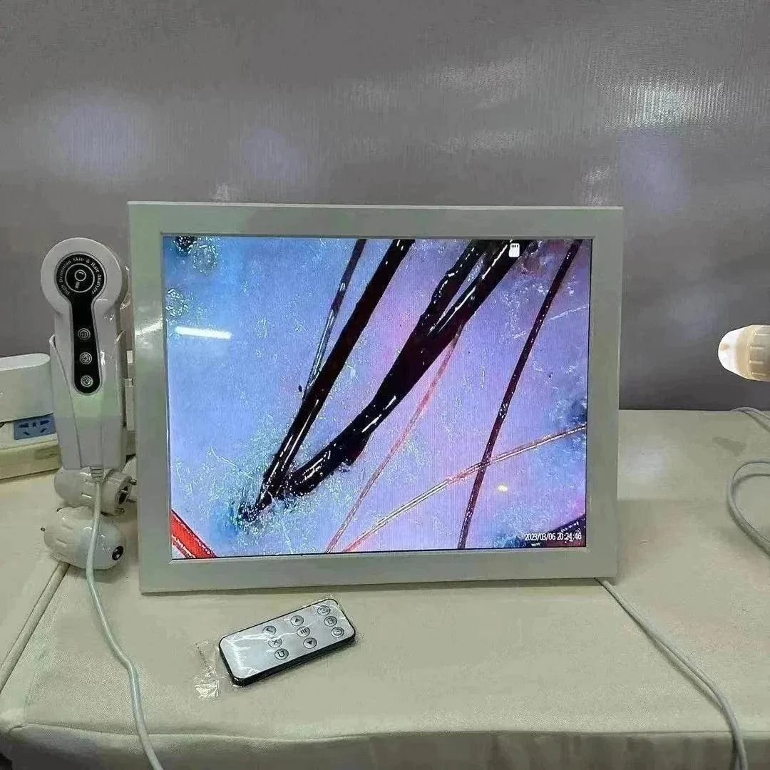 Professional Scalp Analyzer: Discover Scalp Health – Luxe Beauty & Body Co.